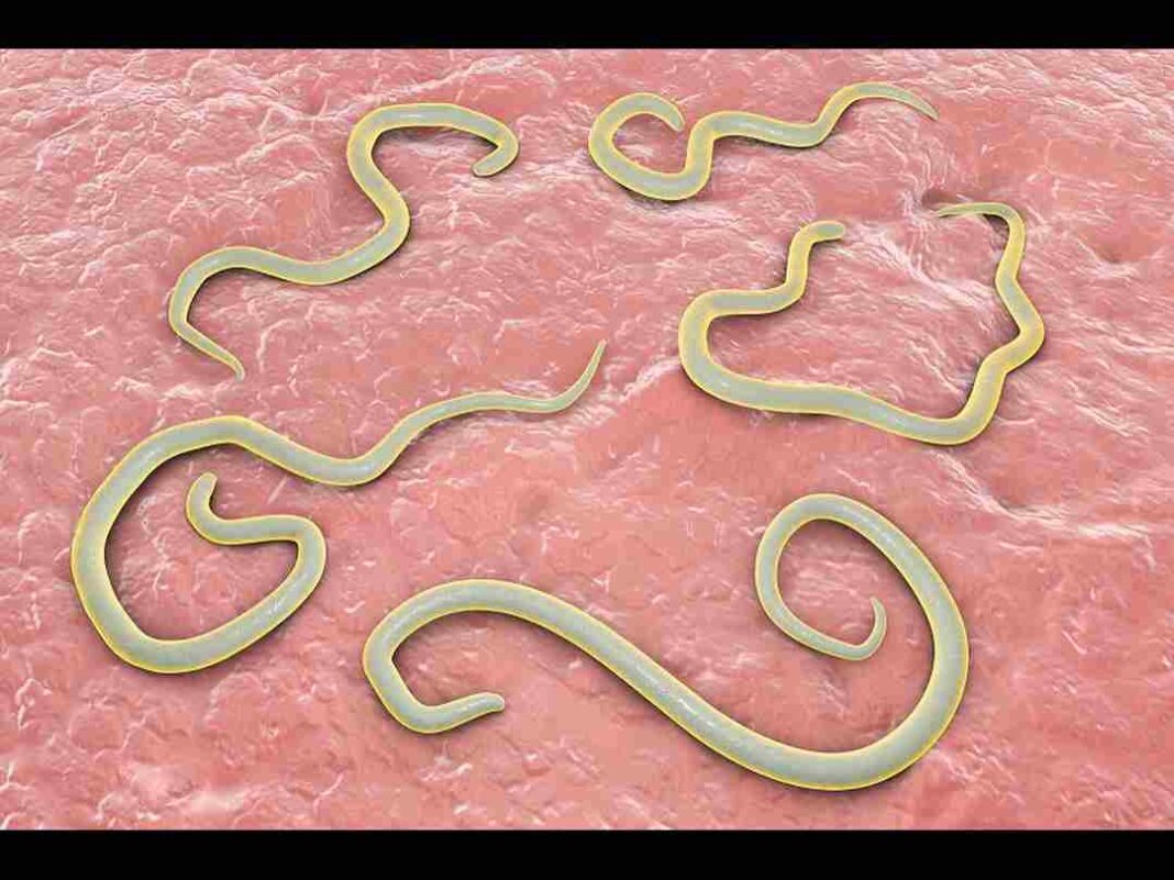 Giun kim là gì và những tác hại gây ra cho con người